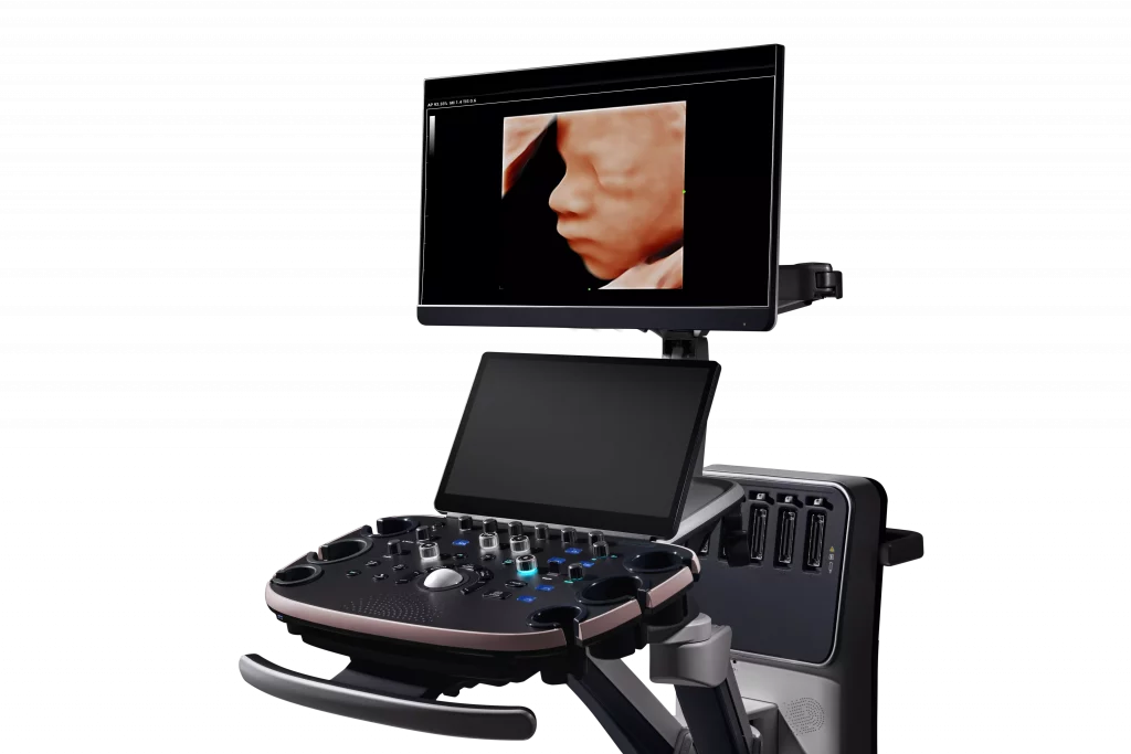 Sonocheck - Ihr Ultraschall Vergleich